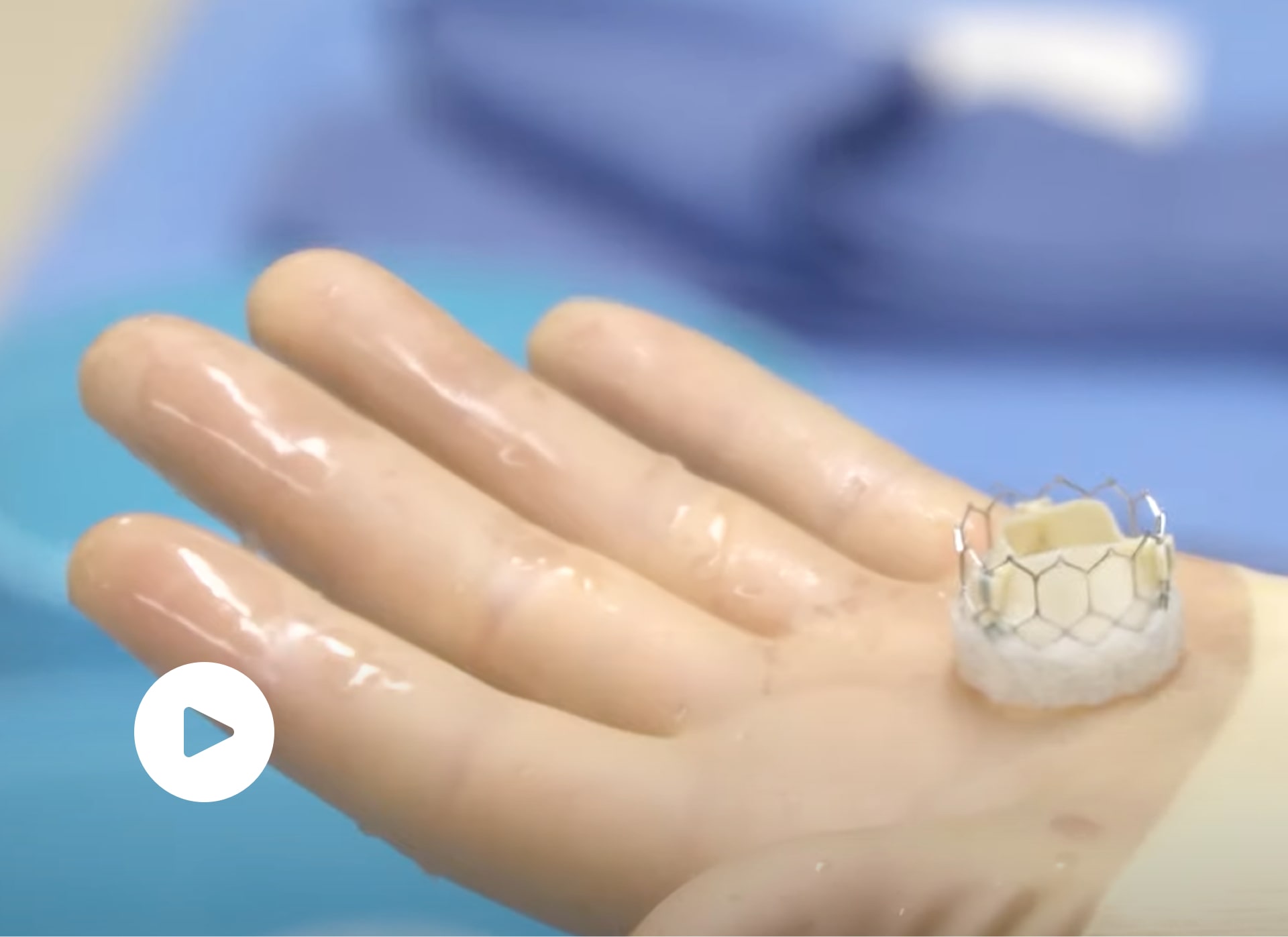 UC Davis Health Transcatheter - Cordis